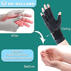 Dr.Welland Medical Arthritis Gloves with Strap, Best Open Finger Glove Hand Wrist Support for Rheumatoid Arthritis