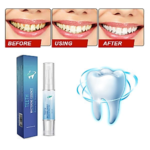 3Pcs Teeth Whitening Pen,Teeth Whitening Gel,Teeth Whitening Essence Pen,Intensive Teeth Stain Remover,Reduce Yellowing Oral Care for Women & Men.