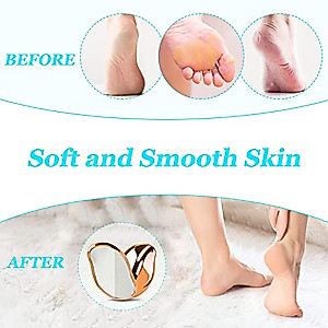 AirOpen Callus Remover for Feet, Safe and Durable Nano Glass Foot File with Storage Bag, Professional Foot Care for Dead Skins, Foot Calluses, Foot Corns and Foot Cuticles (Gold)