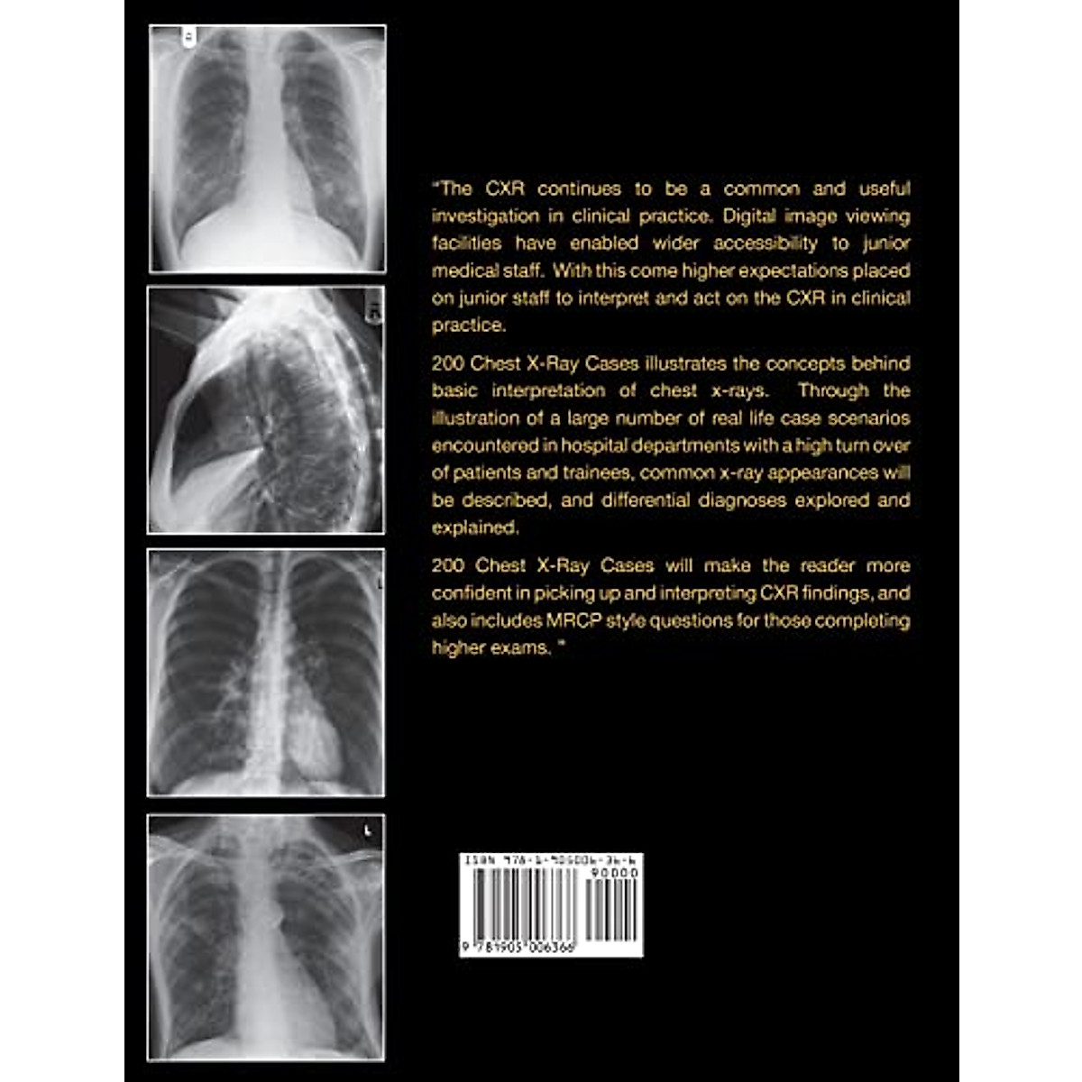 200 Chest X-Ray Cases