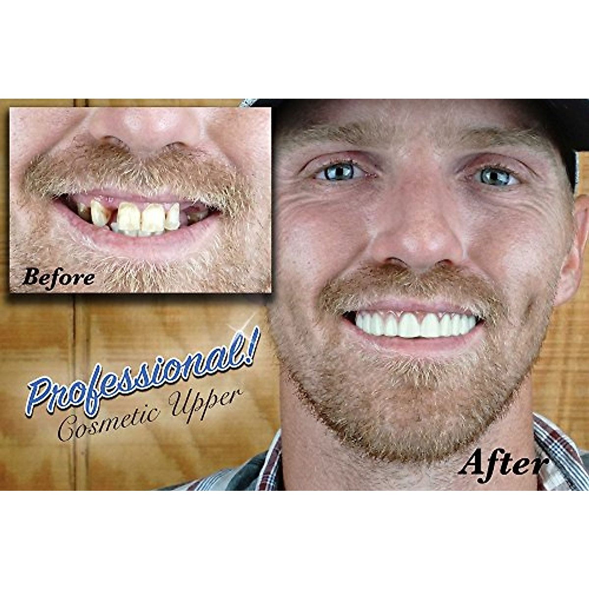 Professional Cosmetic Upper - New from Instant Smile! Hand Crafted Detail, Custom fit at Home! Works Best in Medium to Large Sized Mouths.