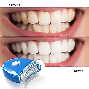 Teeth Whitening Kit (10) Gel (2) Trays (1) White LED Light Best Dental No Animal Byproducts