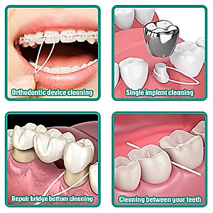 200 Pcs Floss Threaders for Bridges, 4 Packs Dental Floss for Braces, Bridges and Implants, Periodontal Disease Teeth Flossing