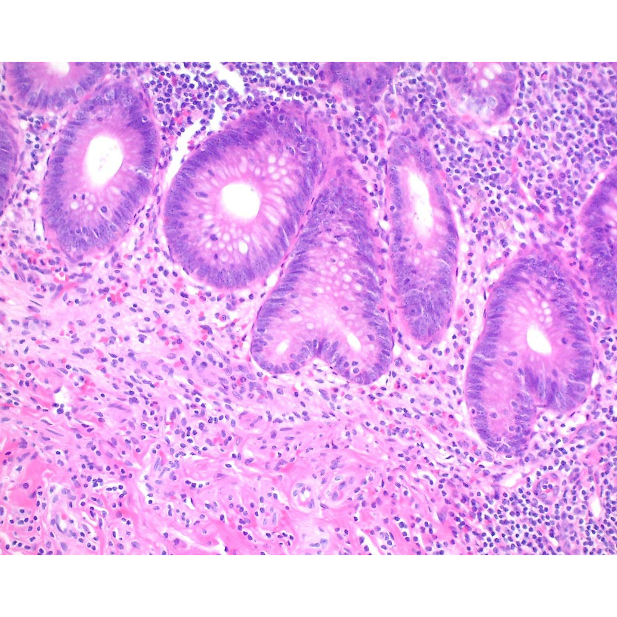Hematoxylin and Eosin Stain Pack, 1000ml