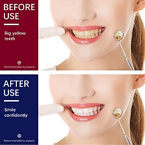 Teeth Whitening Pen 4 Pens for 70+ Uses, Twice a Day for Visibly Whiter in 1 Week, Effective Painless No Sensitivity Vanilla Mint Flavor