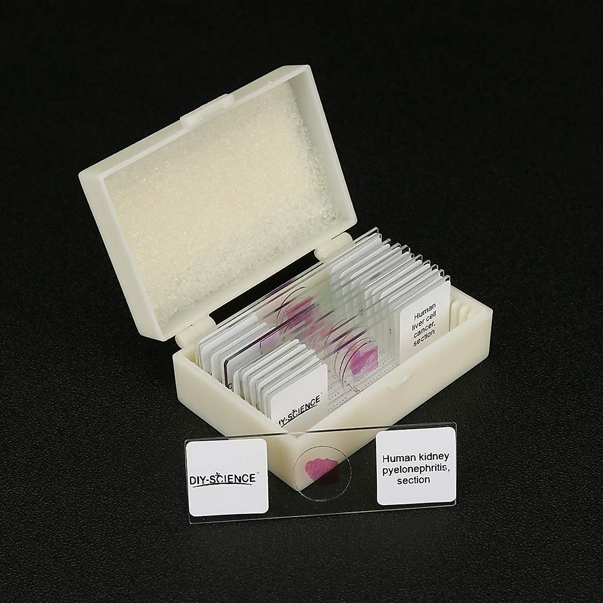 Prepared Human Pathology Microscope Slide Set, 12pcs Research-Quality Prepared Tissue Microscope Slides of Human Diseases (Human Pathology)