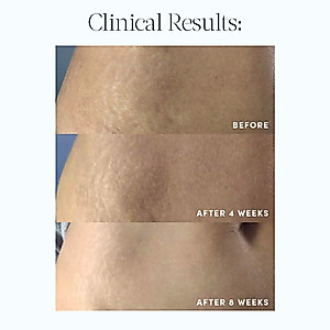 Evereden Golden Belly Serum, 1.7 fl oz. | Belly Oil for Pregnancy | Clean Women's Body care for Pregnancy and Postpartum | Natural and Plant Based Maternity Skincare | Non-Toxic Stretch Mark Oil