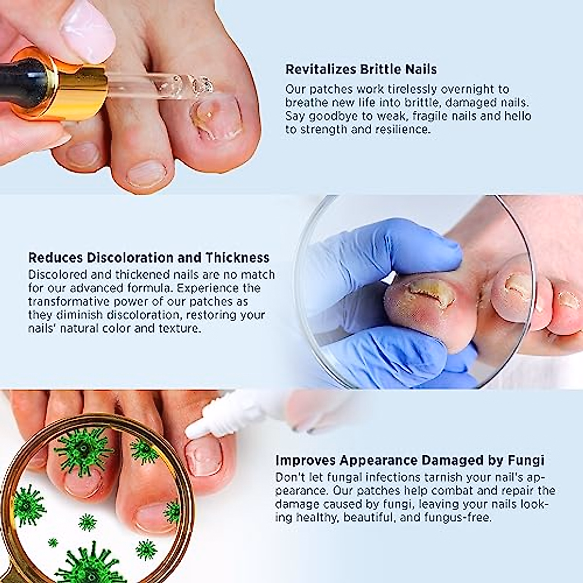 Toenail Fungus Treatment Extra Strength - Nail Fungus Treatment For Toenail, Toe Nail Fungus Treatment Extra Strength, Nighttime Fungal Nail Patches &amp; Fungus Nail Treatment Liquid Set (21patches+15ml)