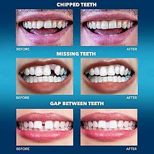 Imako Tooth Tinted Plastic - Natural Color - Temporary Tooth - Made in USA