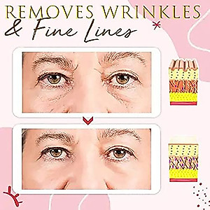 Talkyo Circl Eye Ball Dark Care Skin Remover Slide 15ML Firming Massage Snails Personal Skin Care Gel Eye Pads for Eyelash Extensions (A, One Size)