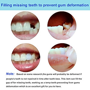 Tooth Repair Kit, Moldable False Teeth Thermal Fitting Beads,Temporary Filling Broken Teeth Gap for Snap On Instant and Confident Smile, Denture Adhesive