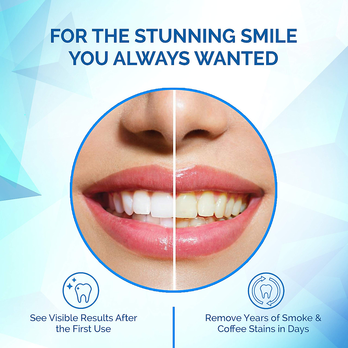 Ghost White Teeth Whitening Kit - Professional LED Light for Whiter Teeth Without Sensitivity, Includes 3 Smart Teeth Whitening Gel Refill Pens, Whitens in Less Than 10 Minutes