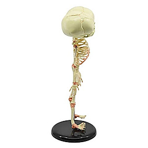 Infant Fetus Skeleton Model, Mini Size - Twin, Conjoined Skull - Rod Mounted - Incredible Detail for Anatomical Study - Eisco Labs