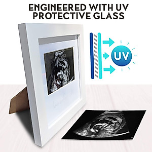 Green Pollywog | Sonogram Picture Frame | White Frame | Ultrasound Frame | Pregnancy Gifts for First Time Moms | Baby Ultrasound Picture Frame | Gifts for Parents/Grandparents | Nursery Decor
