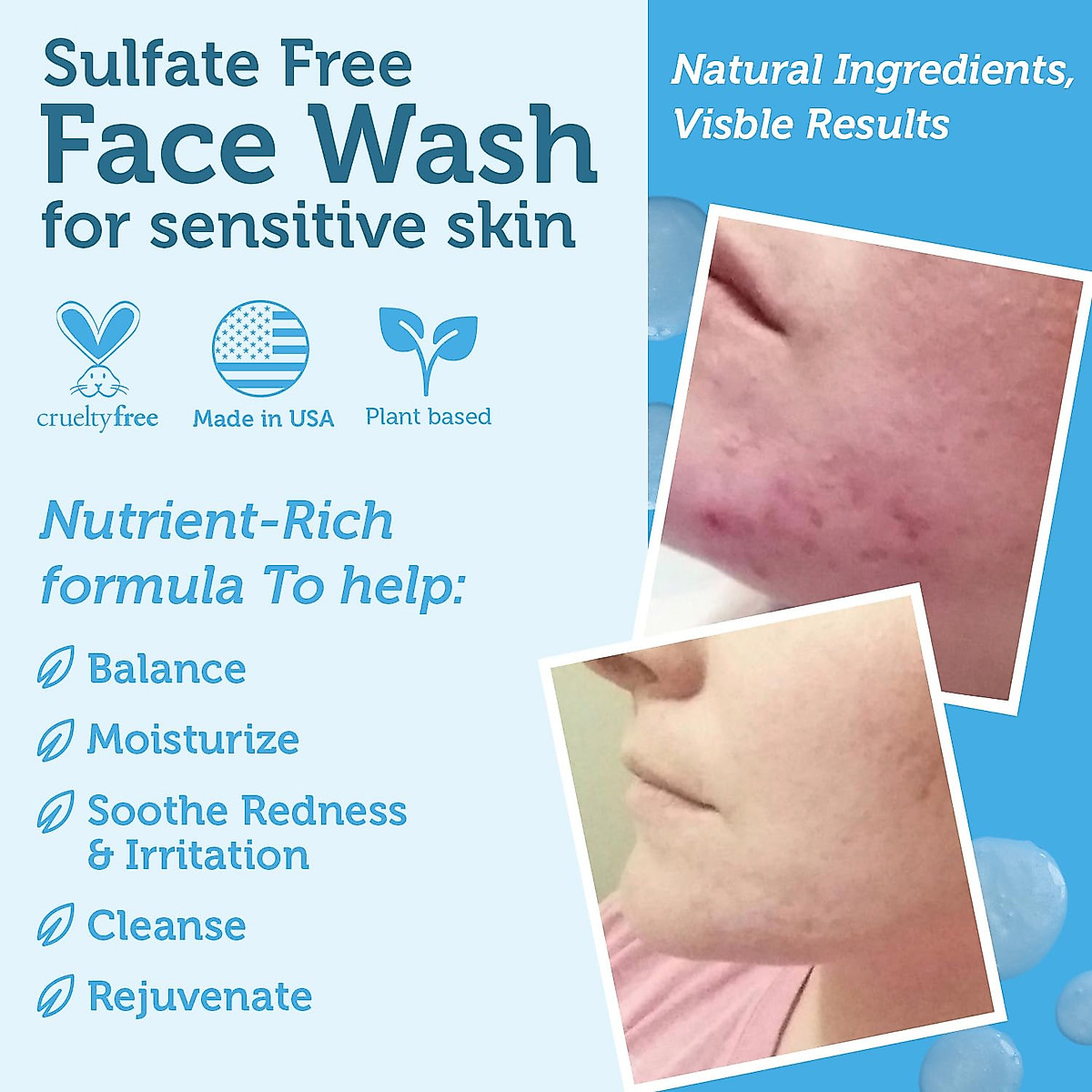 Manuka Honey Face Wash for Women and Men - Sulfate Free Moisturizing Cleanser with Organic Aloe Vera - Soothing Plus Gentle on Dry Skin Facial Cleanser Made in USA - 8oz