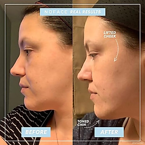 NuFACE MINI Starter Kit ,White