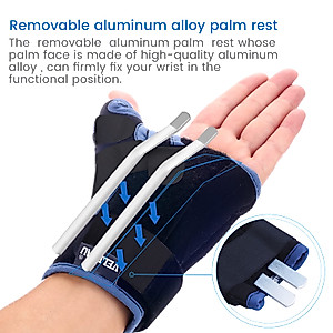 Velpeau Wrist Brace with Thumb Spica Splint for De Quervain's Tenosynovitis, Carpal Tunnel Pain, Stabilizer for Tendonitis, Arthritis, Sprains & Fracture Forearm Support Cast (Short, Left Hand -M)