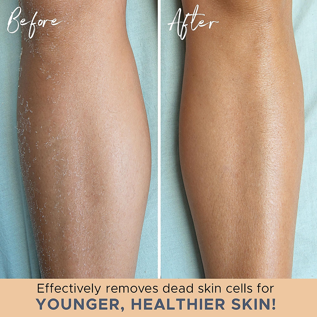 Exfoliating Glove (4 Pcs, 2 Pairs) - Heavy Exfoliate Glove for Dead Skin Bath Exfoliating Gloves for Shower Spa Massage & Body Scrub - Shower Gloves for Women & Men