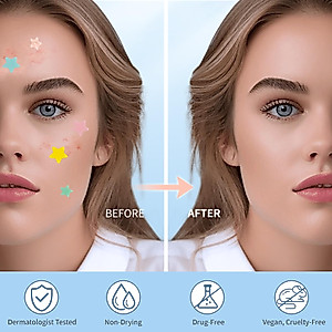 QUSTERE Pimple Patches for Face, Hydrocolloid Acne Patches, Cute Star Zit Covers, Colorful Spot Stickers with Tea Tree, Salicylic Acid & Cica Oil| 3 Sizes (10mm, 12mm & 14mm) |200 Count