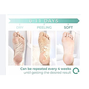 Peach Foot Peel Mask - Repair Cracked Heels, Remove Dead Skin. Makes Your Feet soft And Beautiful
