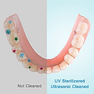 Voraiya® Ultrasonic Cleaner UV for Dentures, Aligner, Retainer, Whitening Trays, Night Dental Mouth Guard, Toothbrush Head, Ultrasonic Cleaner Machine for all dental Appliances, Jewelry, Diamonds