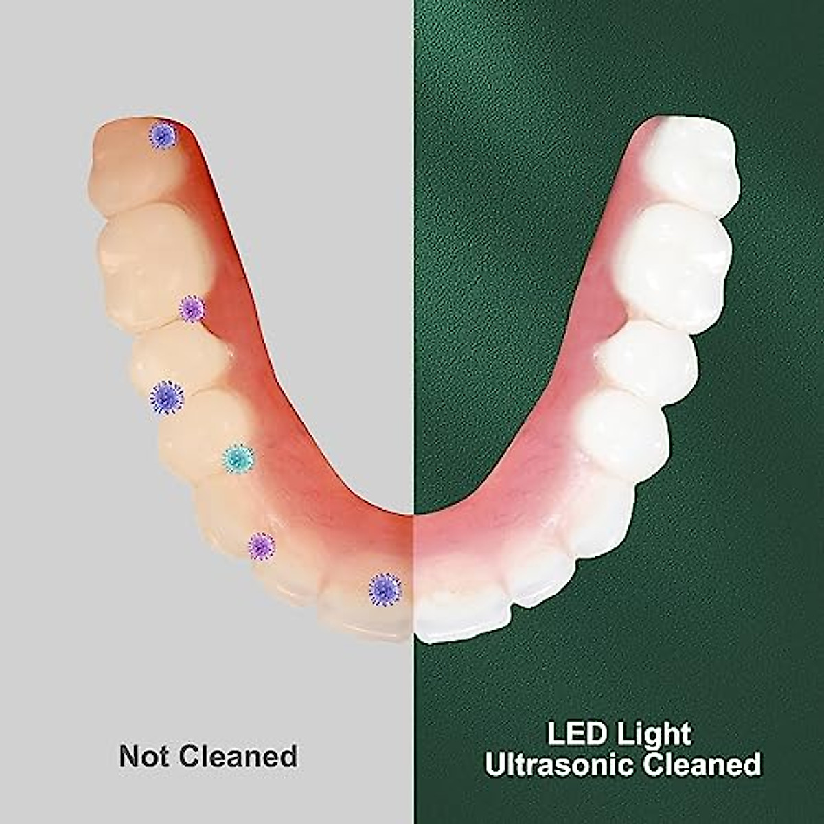 Ultrasonic U-V Cleaner for Dentures, Retainer, Mouth Guard, Aligner, Whitening Trays, Toothbrush Head, 45kHz Ultrasonic Jewelry Cleaner, 200ML Ultrasonic Retainer Cleaner Machine at-Home or Travel Use