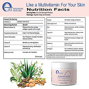 E70 Rosacea Solve - Redness Relief Cream - Calming Face Moisturizer For Rosacea and Acne-Prone Skin - Sensitive Skin Care With Organic Ingredients such as Aloe Vera, Almond Oil, Licorice and Chamomile Extracts - No Parabens