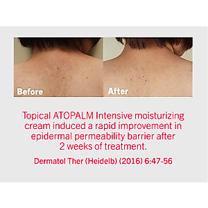 ATOPALM Intensive Moisturizing Cream for Dry & Sensitive Skin, Face Moisturizer, Replenishes Hydration, Paraben-Free, K-Beauty, skin barrier ceramide cream, 3.4 Fl Oz, 100ml (3.4 Fl Oz)