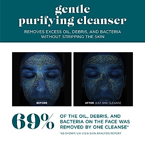 VI Derm Hydrating Gentle Purifying Cleanser, For Daily Use with Aloe Vera, Antioxidants, and Willow Bark Extract, 4 Fl Oz / 120 mL