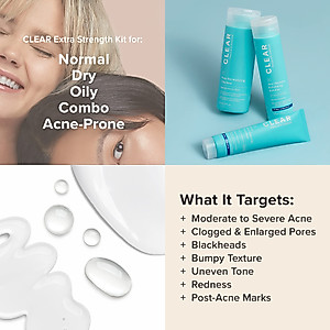 Paula's Choice CLEAR Extra Strength Acne Kit, 2% Salicylic Acid & 5% Benzoyl Peroxide for Severe Acne, Redness Relief, PACKAGING MAY VARY