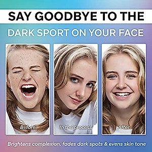 Dark Spot Remover for Face,Dark Spot Corrector Serum,Hyperpigmentation Treatment,Advanced and Natural Formula - - Removes Freckles, Sun Spots, Melasma and More