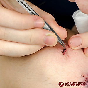 World's Best Tweezers Splinter Out Needle Nose Tweezers - High Precision Fine Point Stainless Steel Tweezers for Ingrown Hair, Ticks, Glass Removal - Diamond Tip Professional Tool for Face & Eyebrows