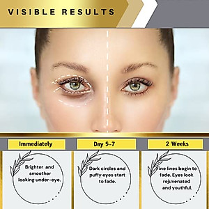 Lookix Collagen Under Eye Patches - Anti-Aging, Dark Circle & Puffy Eye Treatment - Hydrates and Firms Skin - 30 Pairs