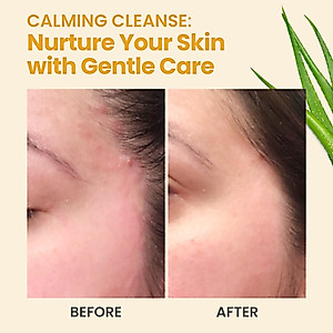 Face and Body Wash for Women and Men - Acne Body Wash Moisturizing for Sensitive Skin - Hydrating Facial Cleanser - Gentle Exfoliating Wash - with Manuka Honey (16oz)