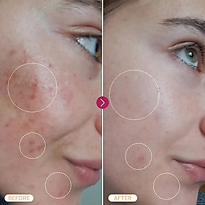 BASE LABORATORIES Hypochlorous Acid Spray for Face & Skin | 8 oz | Magic Facial Spray Daily Skin Repair Solution for Sensitive Skin, Redness, Irritations, Eczema, Acne. Hypochlrous HOCL Molecule Spray