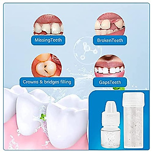 Tooth Repair Kit, Moldable False Teeth,DIY Dental Repair Kit Glue for Broken,Missing, Gaps, Regain Your Beautiful Smile in Minutes-R2