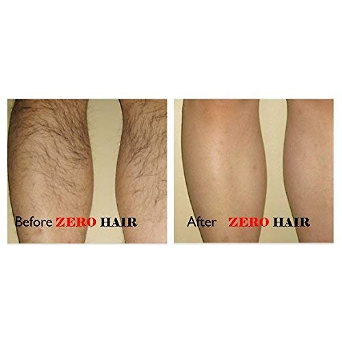 ZeroHair Painless for Women and Men Suitable for Body Skin and Private Parts Leg, Pubic, Bikini Hair Removal Premium Depilatory Cream Kachita Spell Easy Application Fast-Acting 200ml