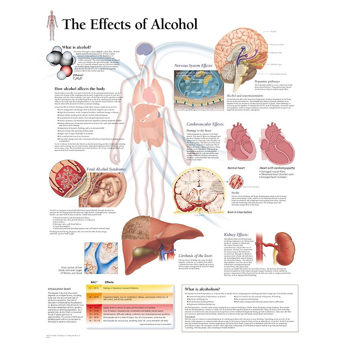 The Effects of Alcohol chart: Wall Chart
