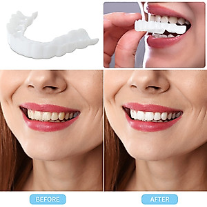 Teeth Veneers 2 Pieces Dental Veneers Fake Teeth Veneers Magic Teeth Brace Fake Top Teeth Customizable Temporary Fake Teeth White Instant Veneers Dentures with Mini Tweezer for Bad Teeth Whitening