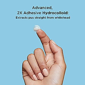 Avarelle Pimple Patches (40 Count) Hydrocolloid Acne Cover Patches | Zit Patches for Blemishes, Zits and Breakouts with Tea Tree, Calendula and Cica Oil for Face | Vegan, Cruelty Free Certified, Carbonfree Certified (40 PATCHES)