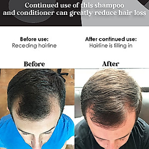 B THE PRODUCT High Potency Biotin Hair Growth Shampoo & Conditioner Set - Fortified with Vitamins E, A, C & B for Fastest Hair Growth (8.5oz.)