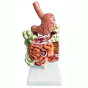 HEYBEC Model of Human Gastrointestinal Anatomy,Model of The Human System, Colon Disease Model, Structure of The Internal Organs for Teaching in Medical Displays