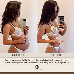Fearless MaMa Stretch Mark Prevention Belly Butter for Pregnancy - 100% Natural Loaded With Ingredients That Nourish & Moisturize. Stretch Marks & Scars Defense (Unscented)