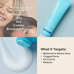 Paula's Choice CLEAR Daily Skin Clearing Treatment with Benzoyl Peroxide, Treats and Prevents Mild to Severe Acne & Breakouts, Fragrance-Free, 2.25 Fl. Oz.