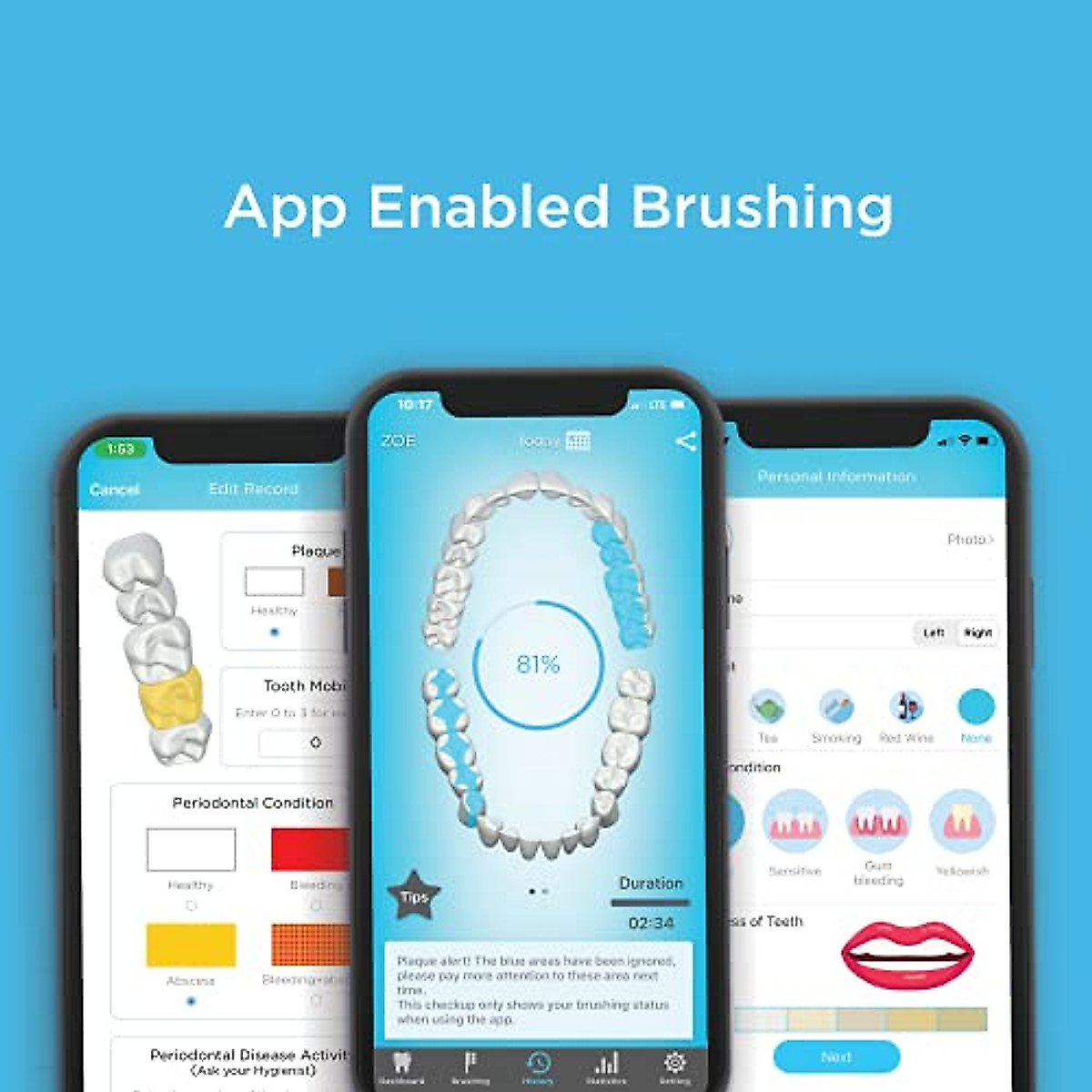 Blu Smart Bluetooth Enabled Kids Toothbrush with Live Tracking App to Teach Children Healthy Brushing Habits, Share Results with Your Dentist (Blue). Wireless Rechargeable Electric.
