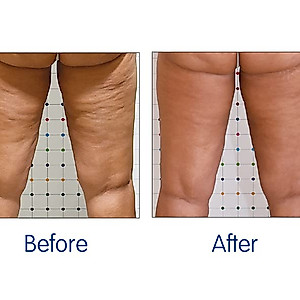 Organic Hair Solution-CELLULITE & STRETCH MARKS CREAM- Advance Formula Maternity Cream- With Neem, Cedarwood, Aloe vera Jojoba seed, Vitamin E,avocado oil, castor oil, green tea oil