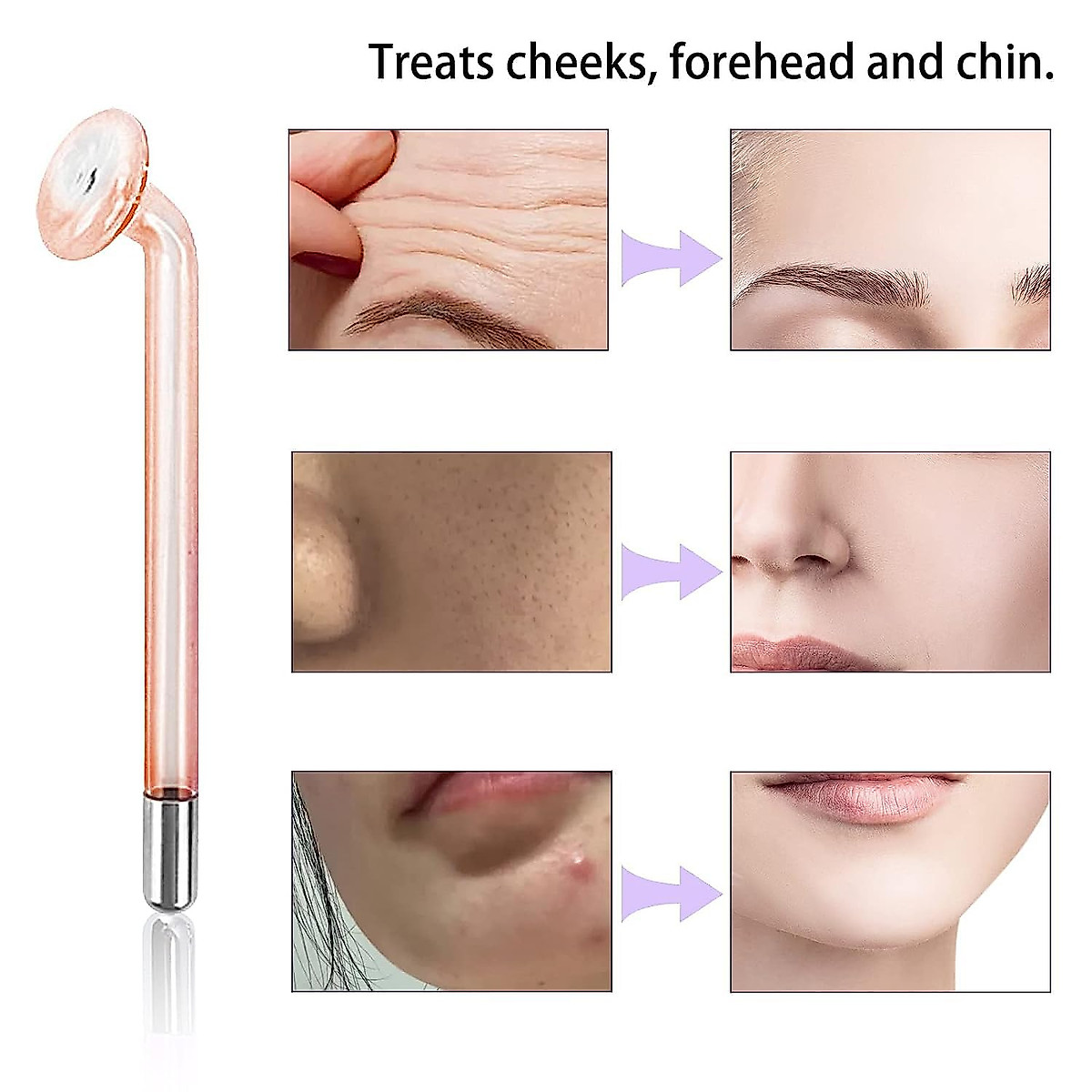 Electrode Wand Glass Tube Handheld Spare Parts for Hi Frequency Instrument Elitzia ETJX006AS (Orange Mushroom)