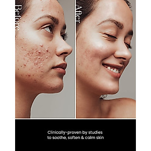 SON&PARK Beauty Water 340ml (11.49 fl. oz) | Multi-Purpose Toner for Oil Control Hydrating Exfoliating Skincare Daily Cleansing Booster with Rose Water Witch Hazel Lavender Oil