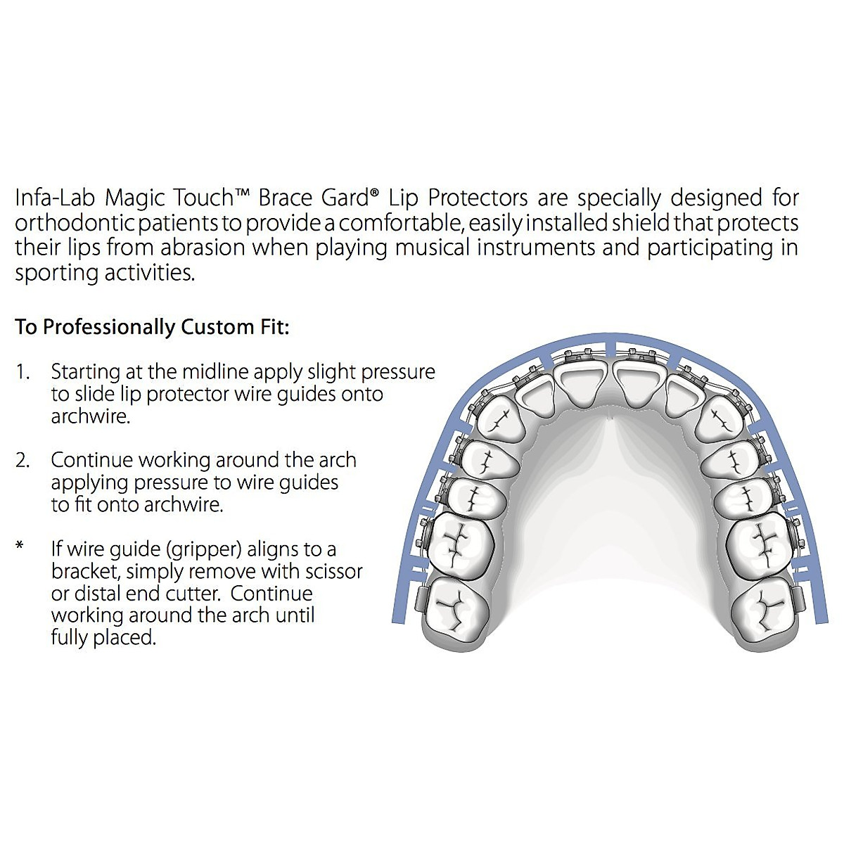 Orthodontic Braces Lip Guard Protector Shield (1 Set - Upper - Lower Teeth) with Instructions by AdentalZ