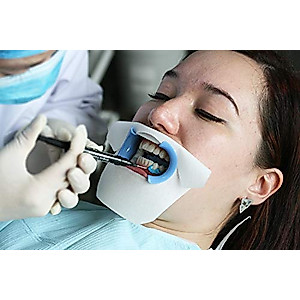 BEYOND FLEXIBLUE Comfort Cheek Retractors | Disposable Dental Cheek Retractors | Plastic Mouth Opener - Medium 10pk